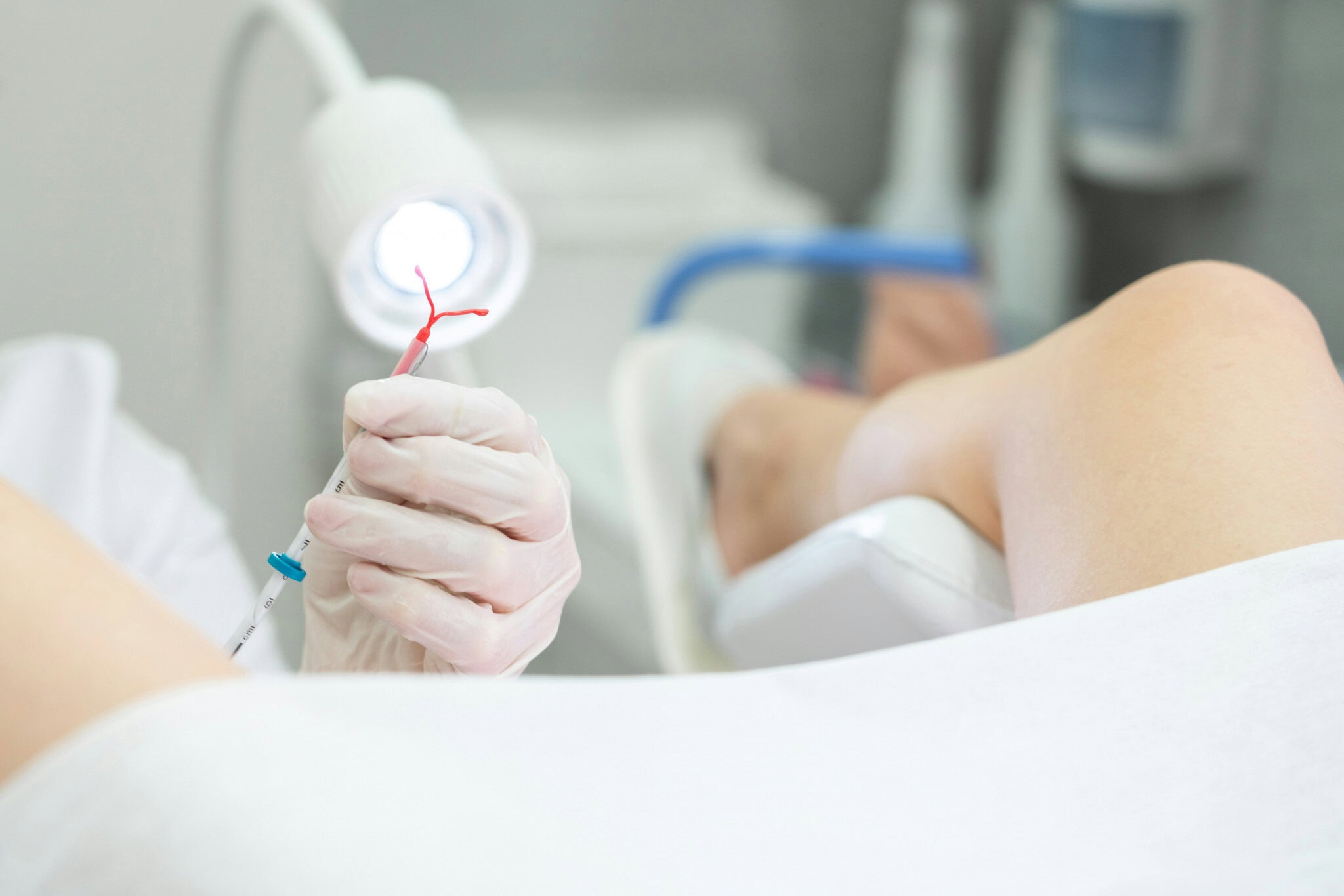 IUD vs IUS: How to Choose the Right Coil for You - Summerhill Health